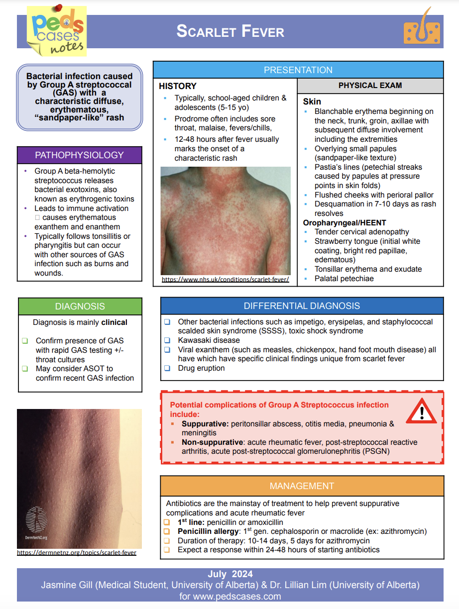 Scarlet Fever | PedsCases